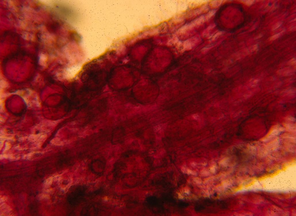 MYCO-WHAT? – Lee Reich